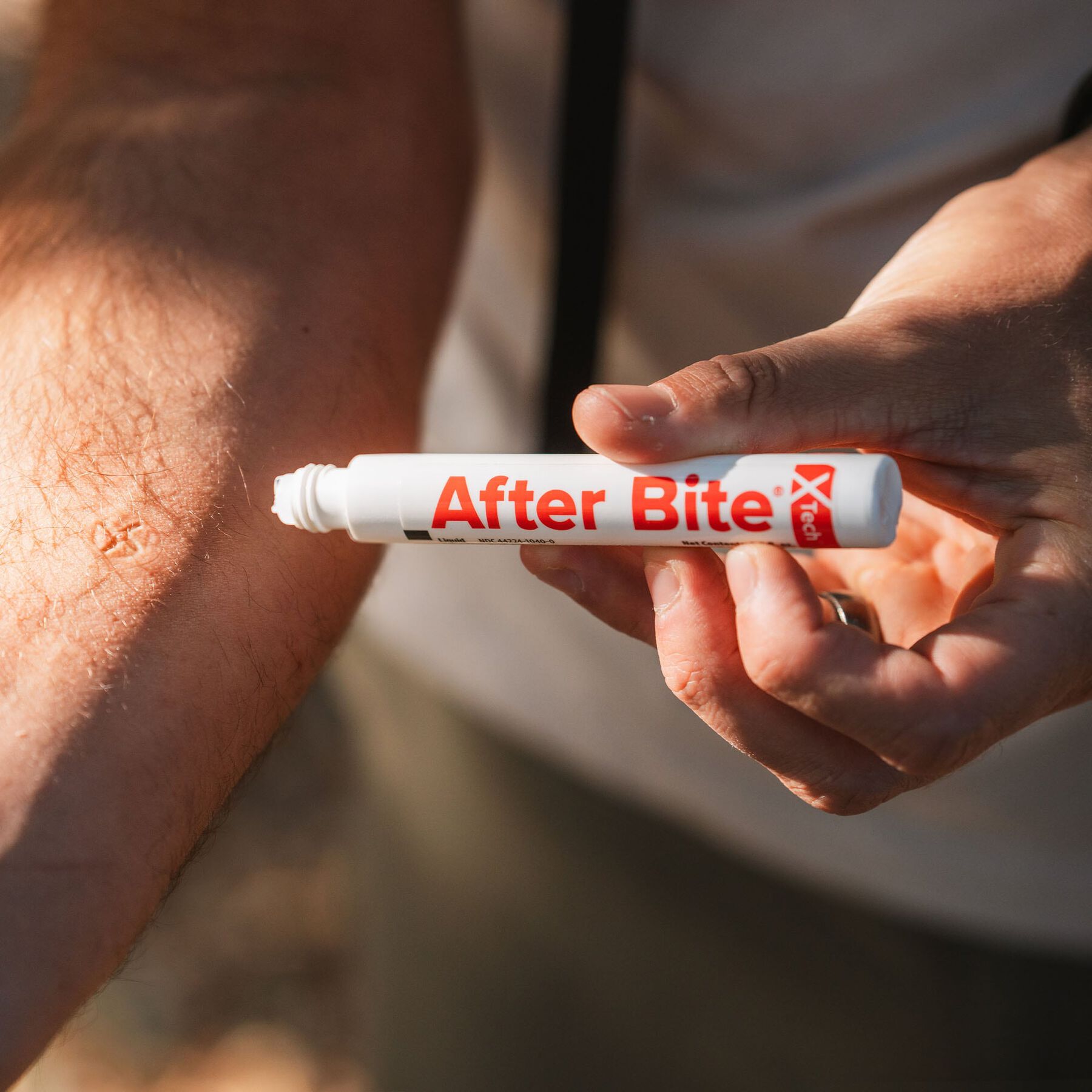 FSA Eligible After Bite X-Tech Targeted Itch Relief Treatment | FSA Store