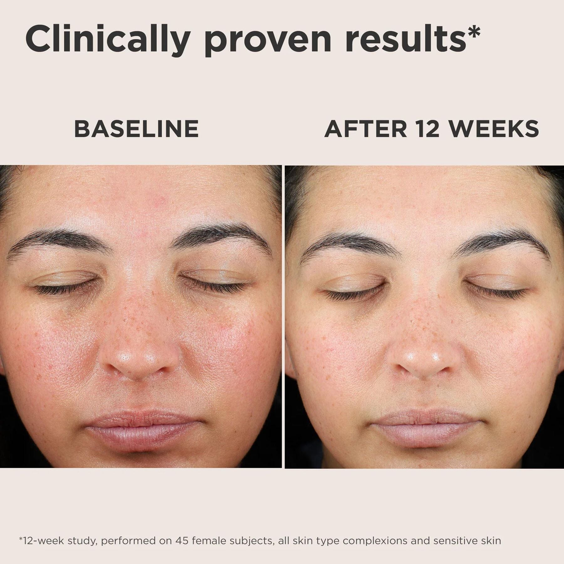 FSA Eligible EltaMD UV Skin Recovery Red Color Correcting Green Tint ...